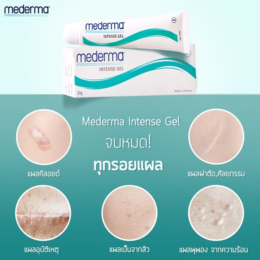Mederma Intense Gel 20g เจลลดรอยแผลเป็น แผลผ่าตัด หลังคลอด (Exp0423 ...