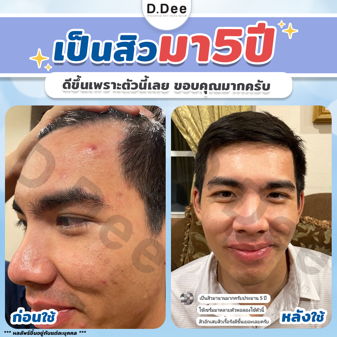 D.Dee, ร้านค้าออนไลน์ | Shopee Thailand