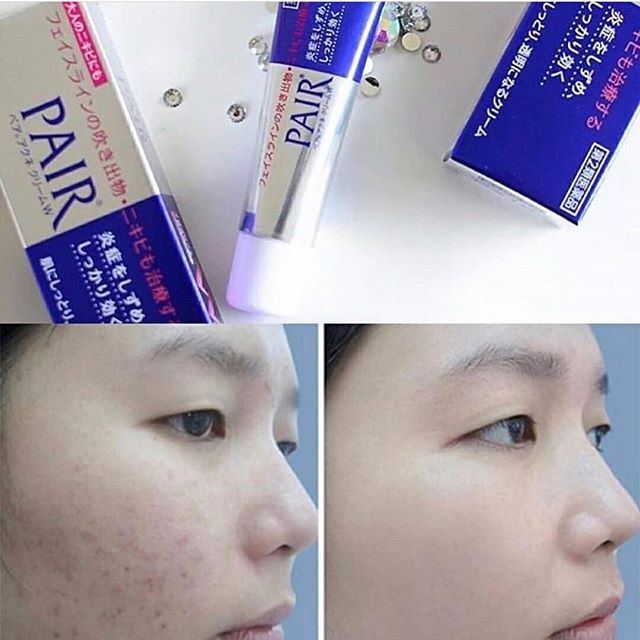 Pair Acne Cream W Size 14 g - my.cosmetic - ThaiPick