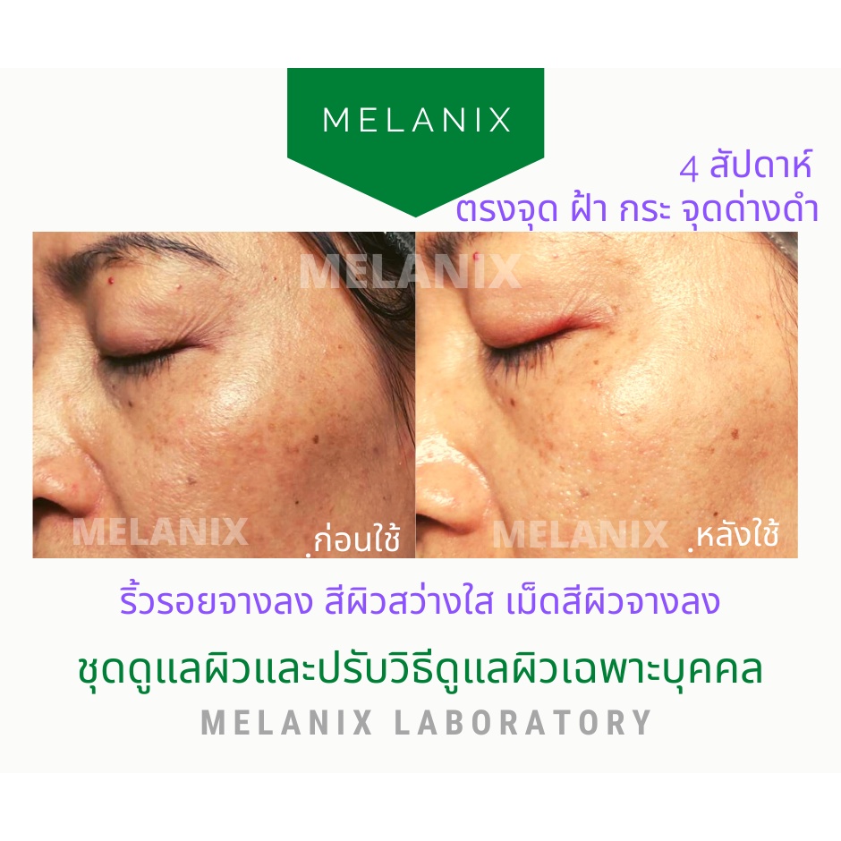 Melanix - ครีมลดฝ้า กระ จุดด่างดำ หมองคล้ำ รอยสิว WHITE UP CREAM 4x ...