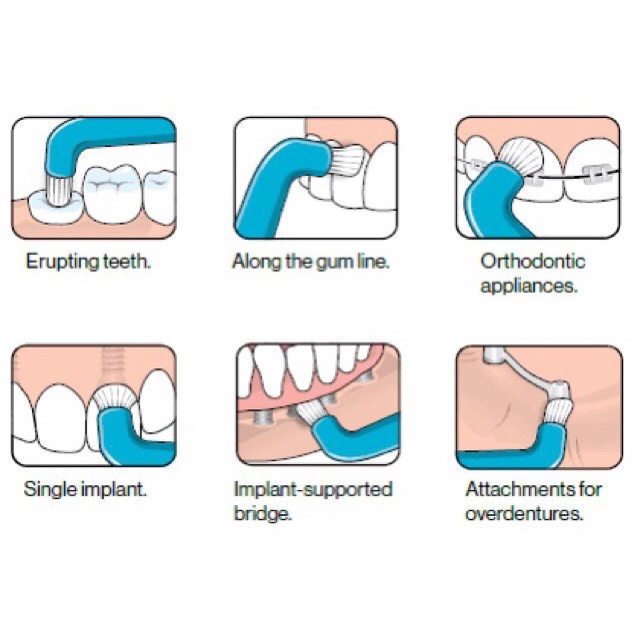 แปรงสีฟัน GUM End Tuft Brush 308 แปรงกระจุก เอน-ทัฟท์ - dental_d - ThaiPick