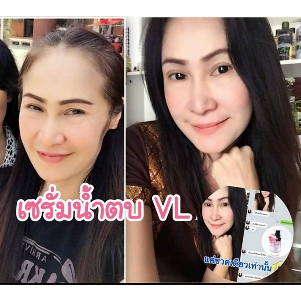 รับเงินคืน10-30โปร 2 แถมอีก 1 ขวดส่งฟรี-มีของแถม Dora VL เวอร์บีน่า ลีฟติ้ง เซรั่มลดริ้วรอย ถุง ...