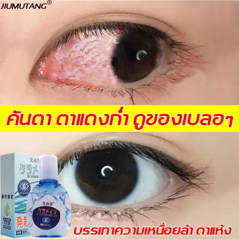 พร้อมส่งNatear eye drop น้ำตาเทียม รายวัน รายเดือน - drugplus - ThaiPick