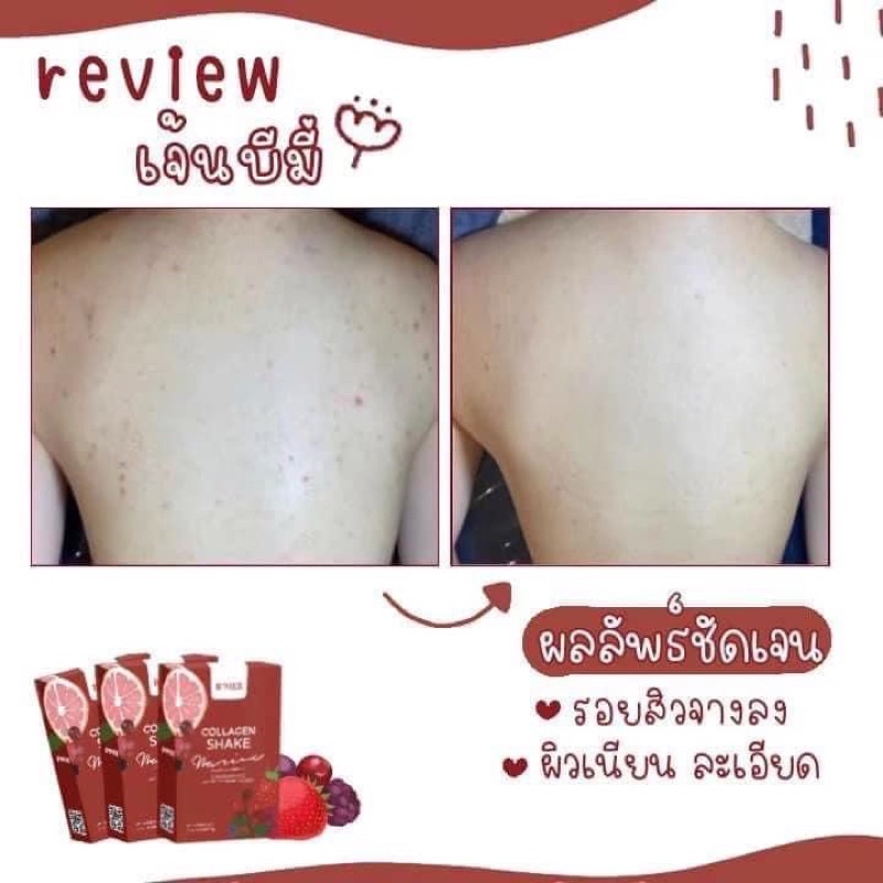 มีของแถมส่งไว Bmee คอลลาเจน บีมี่ ผิวขาว บำรุงผิว ลดริ้วรอย - bmeesociety - ThaiPick