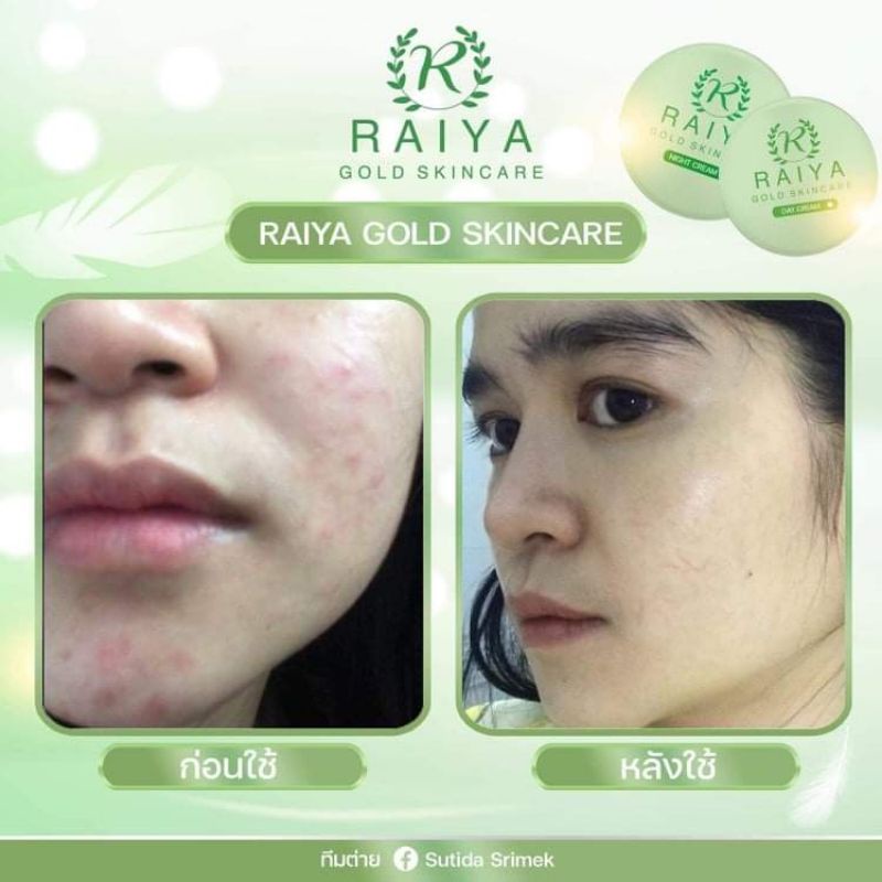 ครีมไรยาRaiya ครีมไรยาหน้าใส - martin.nall - ThaiPick