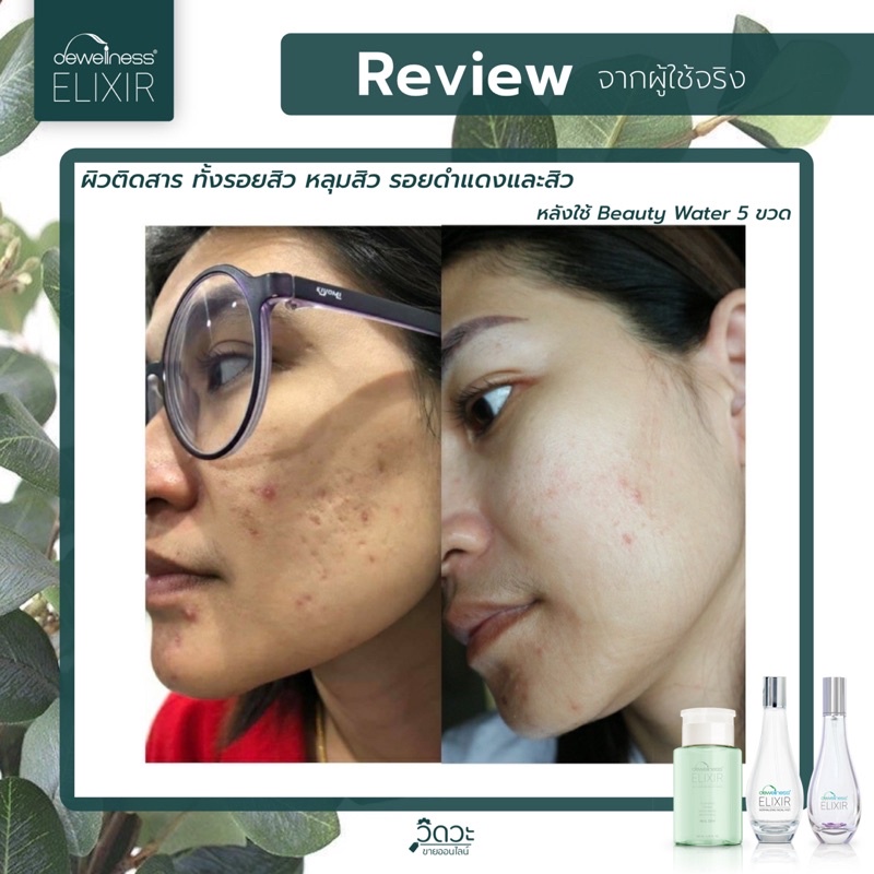 ส่งฟรี มีปลายทางลดทันที 110 บาท - น้ำค้างธรรมชาติ - บิวตี้ - DEWellness Elixir - คลีนซิ่ง โทนเน ...