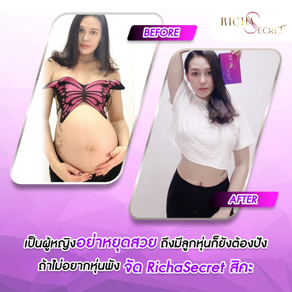 RichaSecret ผลิตภัณฑ์อาหารเสริม - richa_s_secret - ThaiPick