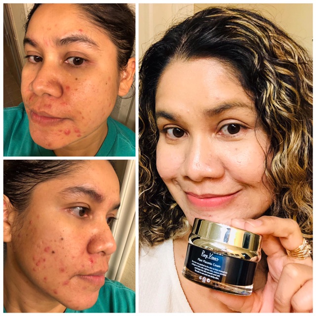 โค้ดส่วนลด 5 Ray Viear Placenta Night Cream ครีมเรเวียร์ ครีมบำรุงสกัด ...