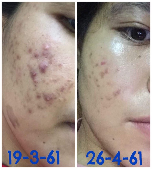 Ray Viear Plant Placenta Night Cream เรเวียร์ แพลนต์ พลาเซนต้า (ไนท์ ...