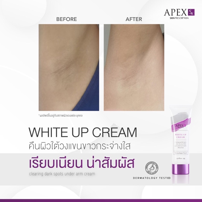 APEX-SX WHITE UP CREAM ครีมทารักแร้ขาวสูตรคุณหมอเอเพ็กซ์ ทาขาหนีบดำ ...