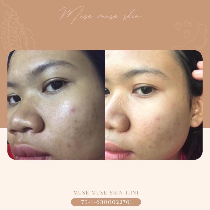 พอกกู๊ดโสม ขัด ????สครับมะขามนมผึ้ง Muse muse skin มาส์ก+ครับ2in1 ลดสิว ...