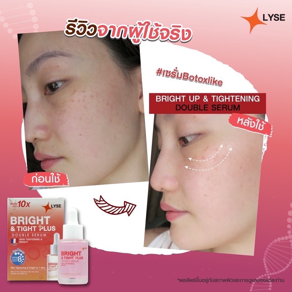 Lyse Bright Tight Plusลิเซ่เซรั่มยกกระชับ ลดริ้วรอย ปรับผิวให้กระจ่างใส ...
