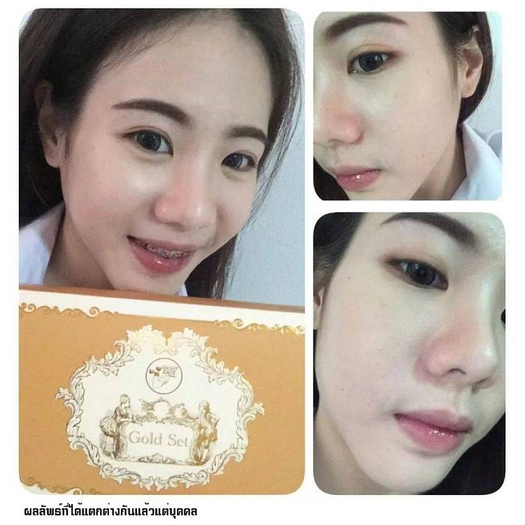Freshy Face Gold Set โกลด์เซ็ทของแท้ - shoponsale_wp - ThaiPick