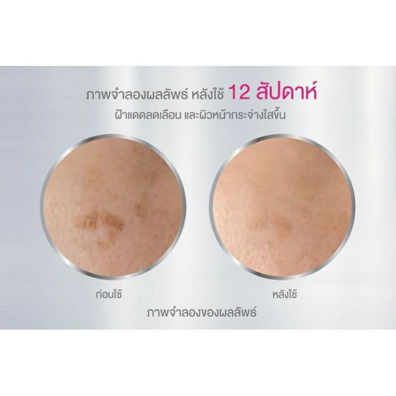 Nivea Luminous 630 นีเวีย ลูมินัส 360 30ml. พร้อมส่ง แท้???? - moto47.7 ...