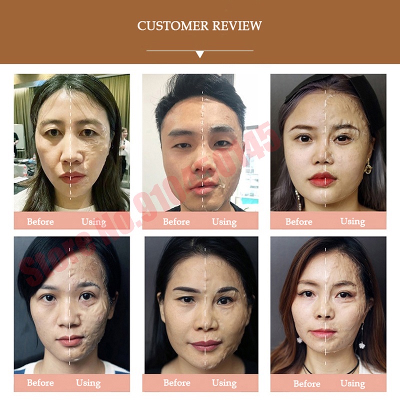 Korean Cosmetic Miracle Anti Aging Face Mask Hanacure Facial Mask Face ...
