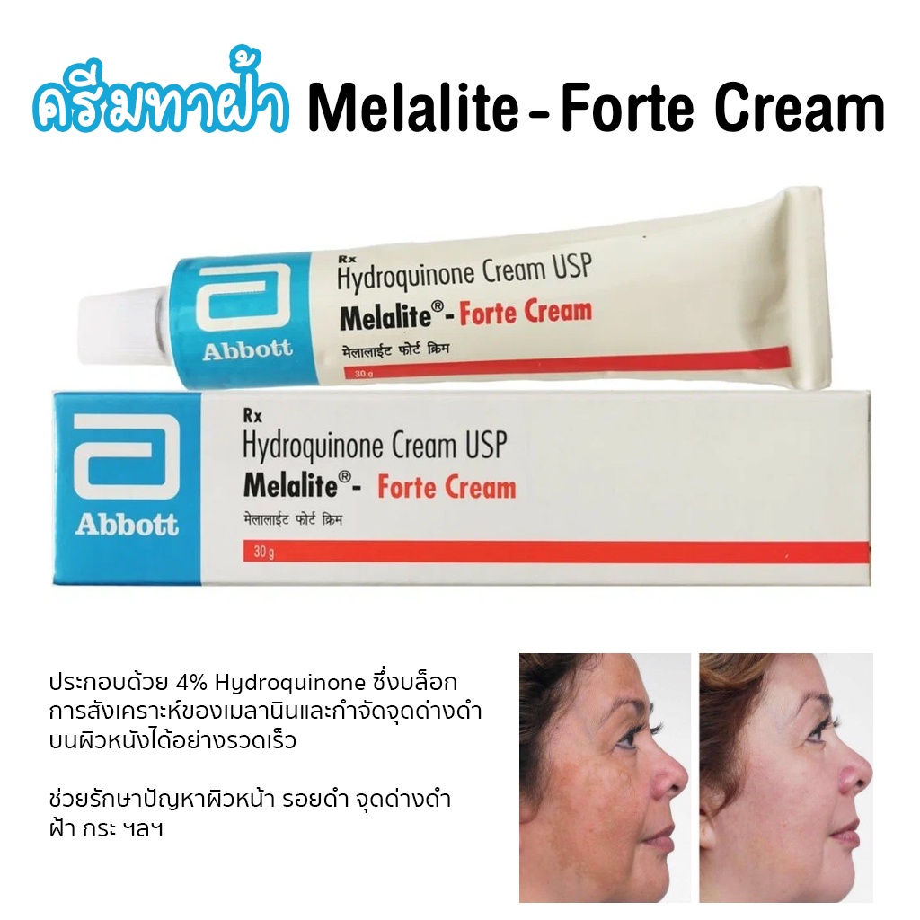 Melalite Forte Cream 30g ครีมทาฝ้า กระ จุดด่างดำ - nanabandan - ThaiPick