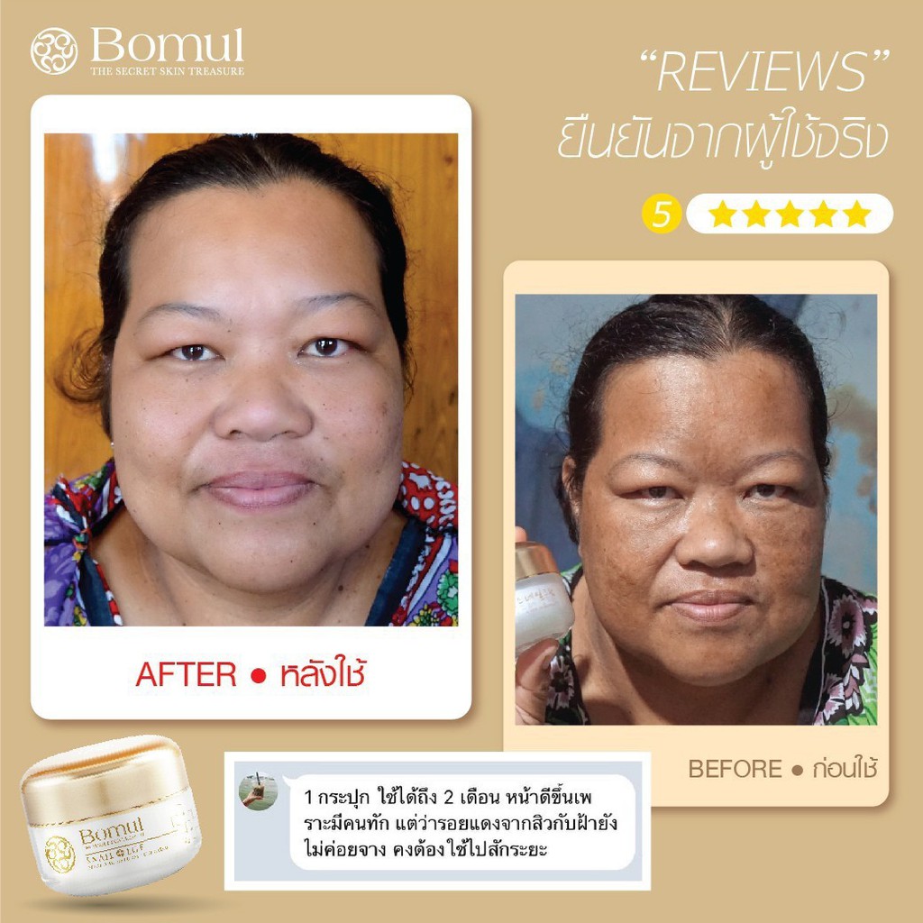 ขายดีมาก แนะนำ Bomul Snail Cream+EGF ครีมโบมุล ครีมบำรุงผิว ช่วยให้ฝ้า ...