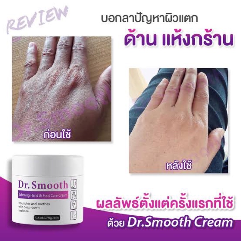 ครีม Dr.Smooth แก้ปัญหาผิวลอก เท้าแห้งกร้าน ตัวนี่ช่วยคุณได้ทุกปัญหาผิว ...