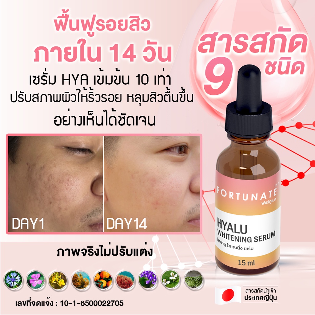 HOTพร้อมส่ง เซรั่มลดสิว ฟื้นฟูหลุมสิว ริ้วรอย ฝ้า กระ จุดด่างดำ เห็นผล ...