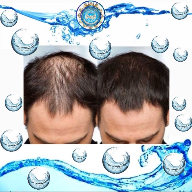 Finasteride1mg harifinแฮริฟิน 1 mg. 1 กล่อง 30 เม็ด - popup99 - ThaiPick