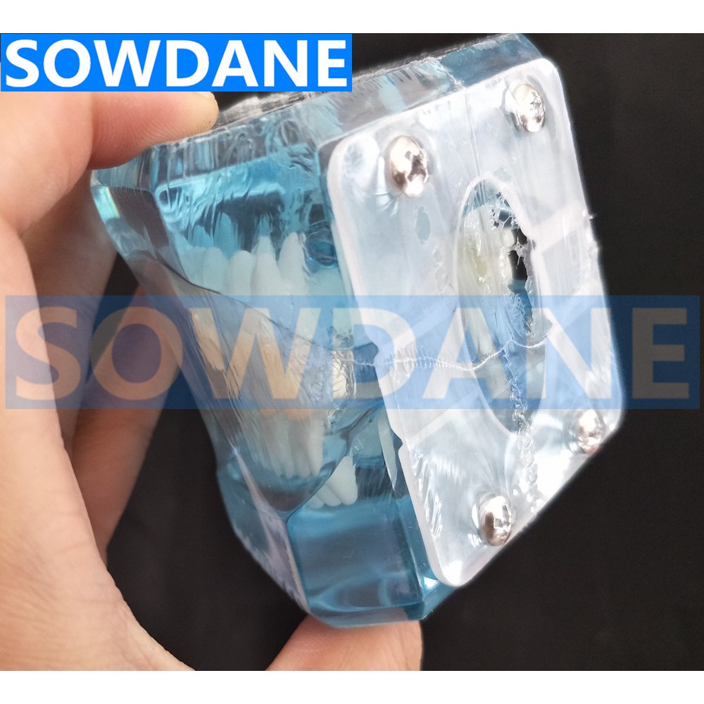 Dental Standard Tooth Model Orthodontic Model for Communication Dental ...
