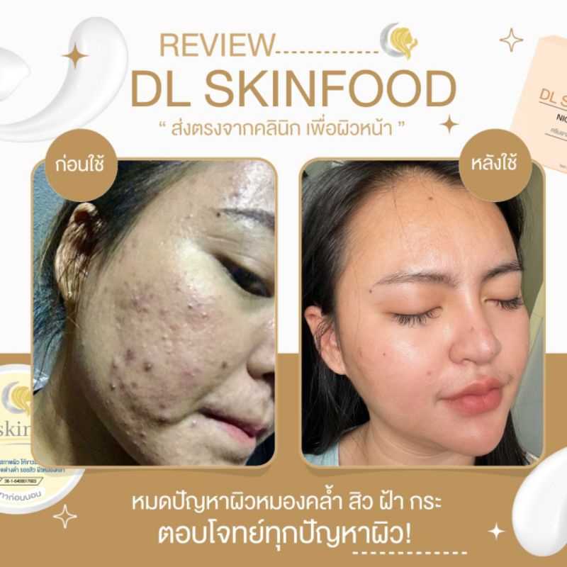 Deli Skin 10กระปุก(ราคาเปิดบิล) ของแท้ 1️⃣0️⃣0️⃣ อาหารผิว ขาวไวเร่งด่วน ...