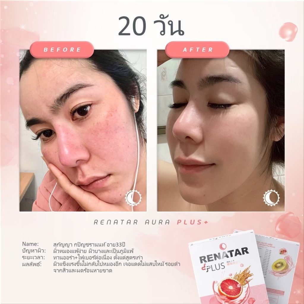 Renatar เรนาต้า 3 สูตร อาหารเสริม BB Plus Boost Burn / Fiber X ไฟเบอร์ เอ็กซ์ / Collagen Aura ...