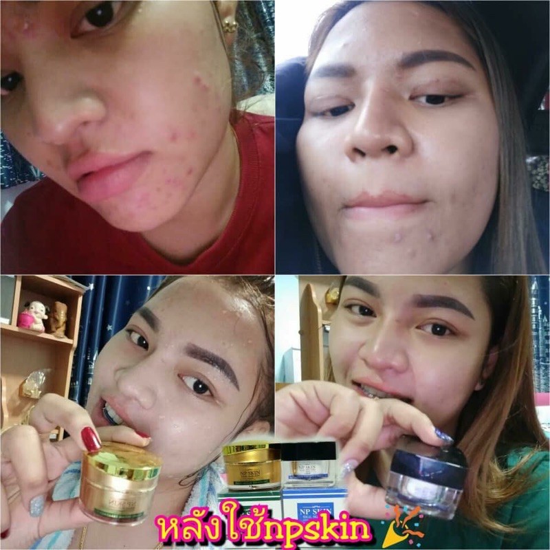 NPSKIN ครีมไนท์รีแพร์+CM ll คู่นี้ส่งฟรี????มีบริการเก็บเงินปลายทาง ของแท้???? - fh.shop53 ...