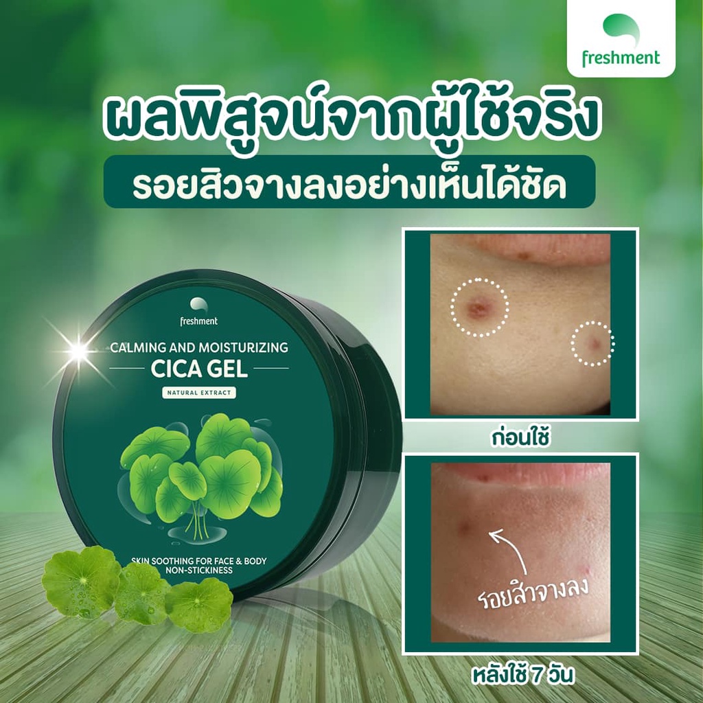Freshment Calming and Moisturizing CICA Gel 300 ml. คาล์มมิ่ง แอนด์มอย ...