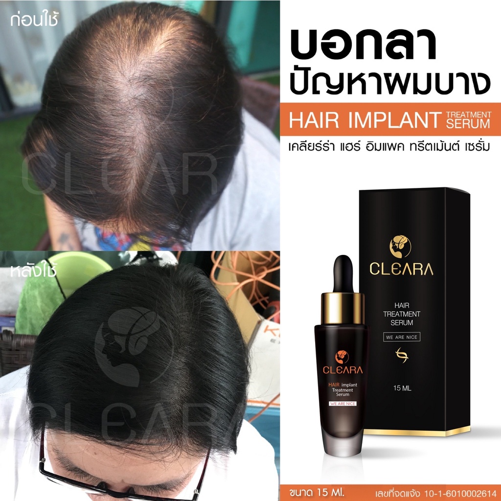 Cleara 2แถม1 ส่งฟรี เคลียร่า กระตุ้นผมใหม่ เซรั่มปลูกผม คิ้ว หนวด จอน ปลูกไรผม ลูกผม บำรุงเส้นผม ...