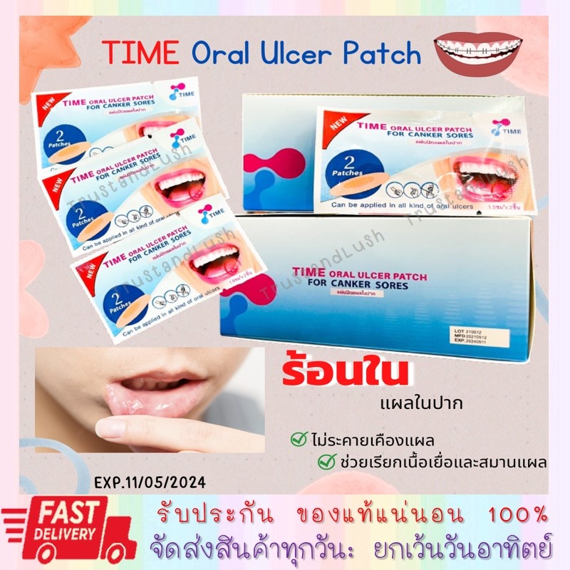 TIME ORAL ULCER PATCH แผ่นแปะแผลร้อนใน - ART Healthcare - ThaiPick
