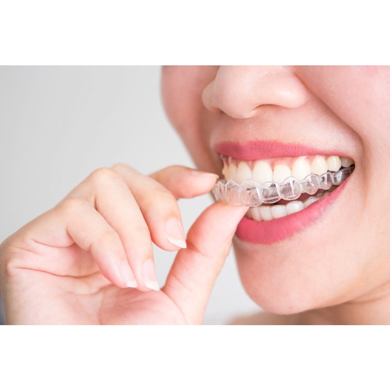 Clear Retainer รีเทนเนอร์แบบใส(ความหนา 0.4mm) - dentalpro_store - ThaiPick