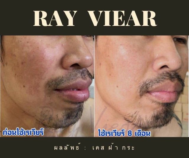 ส่งฟรี Ray Viear Plant Placenta Cream - vinnara - ThaiPick