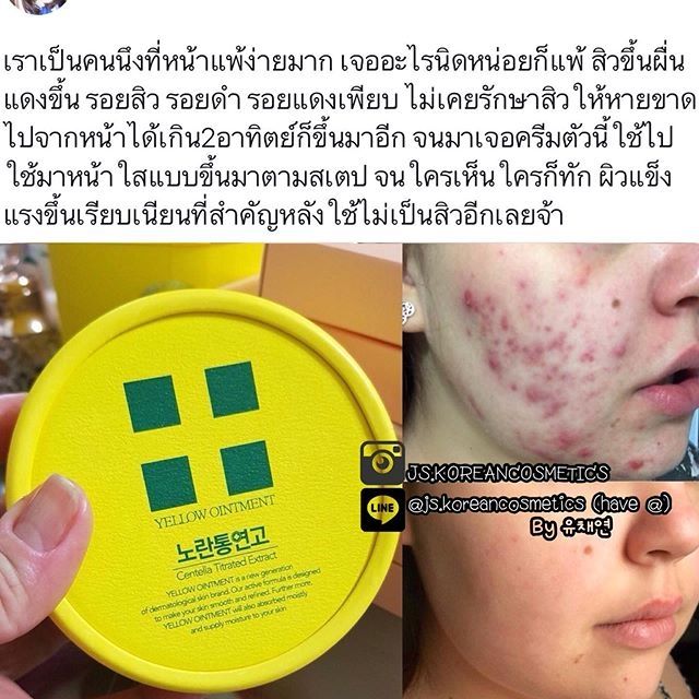 พร้อมส่ง Yellow Ointment Centella treated Extract Cream 18g. # ...