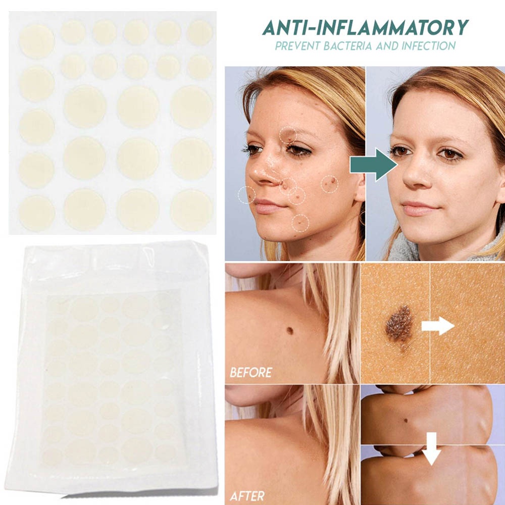 1Bag Skin Tag Remover Patch Ance Pimple Patch Plaster Acne Cream ...