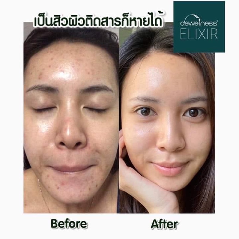 ส่งฟรี มีปลายทางลดทันที 110 บาท - น้ำค้างธรรมชาติ - บิวตี้ - DEWellness Elixir - คลีนซิ่ง โทนเน ...