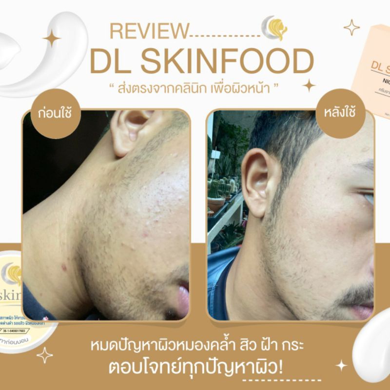 Deli Skin 10กระปุก(ราคาเปิดบิล) ของแท้ 1️⃣0️⃣0️⃣ อาหารผิว ขาวไวเร่งด่วน ...