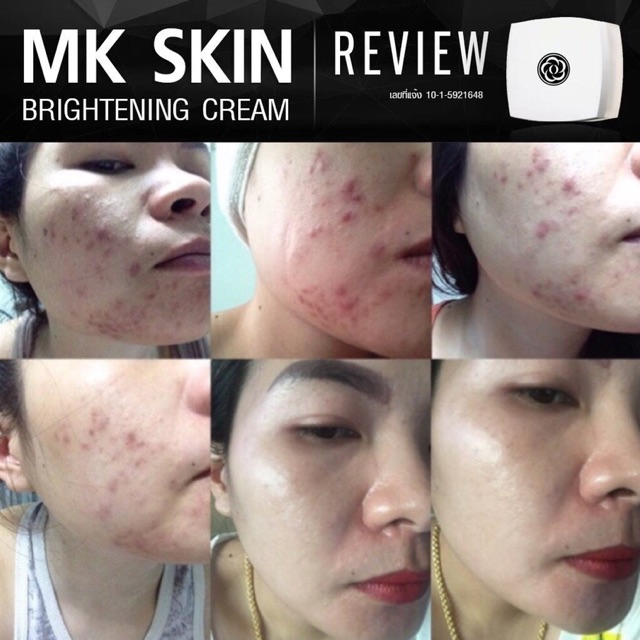 MK Skin - Brightening Cream ลืมไปเลยว่าเคยแพ้ จะหาครีมที่ช่วยฟื้นฟูผิว ...