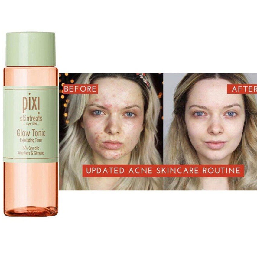 Pixi 100ML 5 Glycolic Acid Glow Tonic Moisturizing Oil-Controlling ...