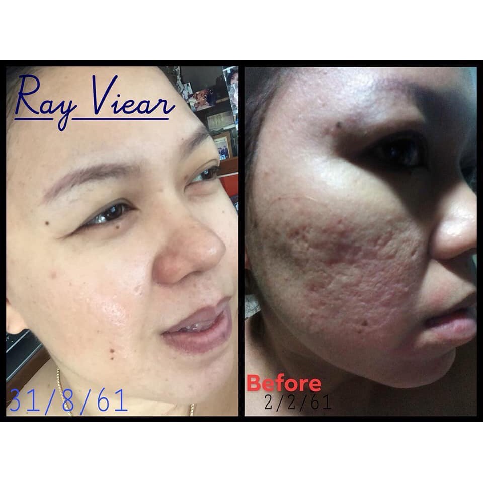 Ray viear Plant Placenta Night Cream ครีมบำรุงผิวหน้า - nuunong.shop ...