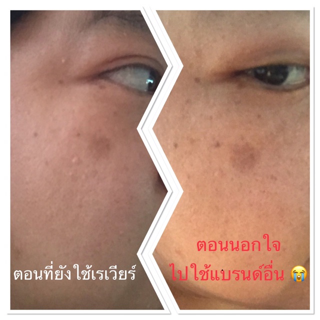 โค้ดส่วนลด 5 Ray Viear Placenta Night Cream ครีมเรเวียร์ ครีมบำรุงสกัด ...
