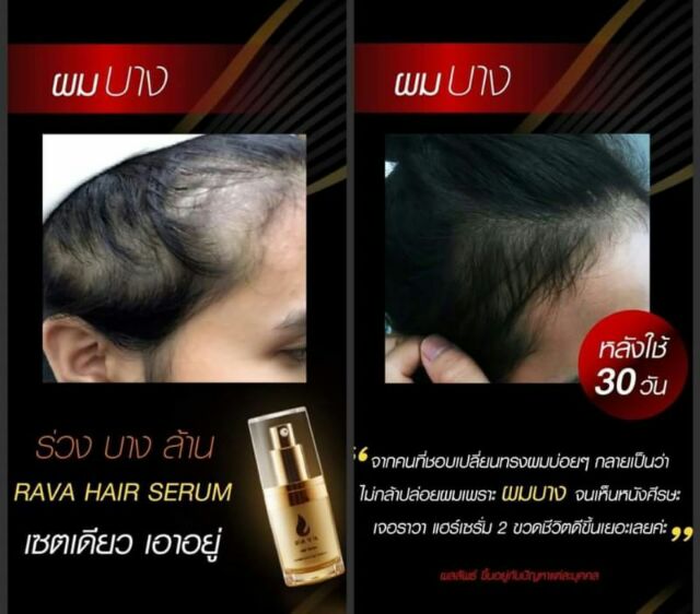 RAVA Hair serum Shopee - bakitakeshikun - ThaiPick