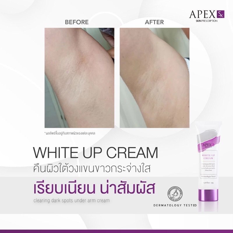 APEX-SX WHITE UP CREAM ครีมทารักแร้ขาวสูตรคุณหมอเอเพ็กซ์ ทาขาหนีบดำ ...
