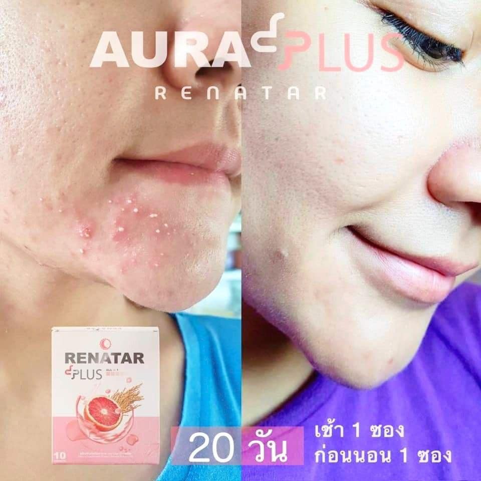 [สั่งเรทตัวแทนทางแชท] เรนาต้า ออร่า พลัส Renatar Aura Plus ++ สู้สิวผิวใสออร่าท้าแดด - joann_na ...