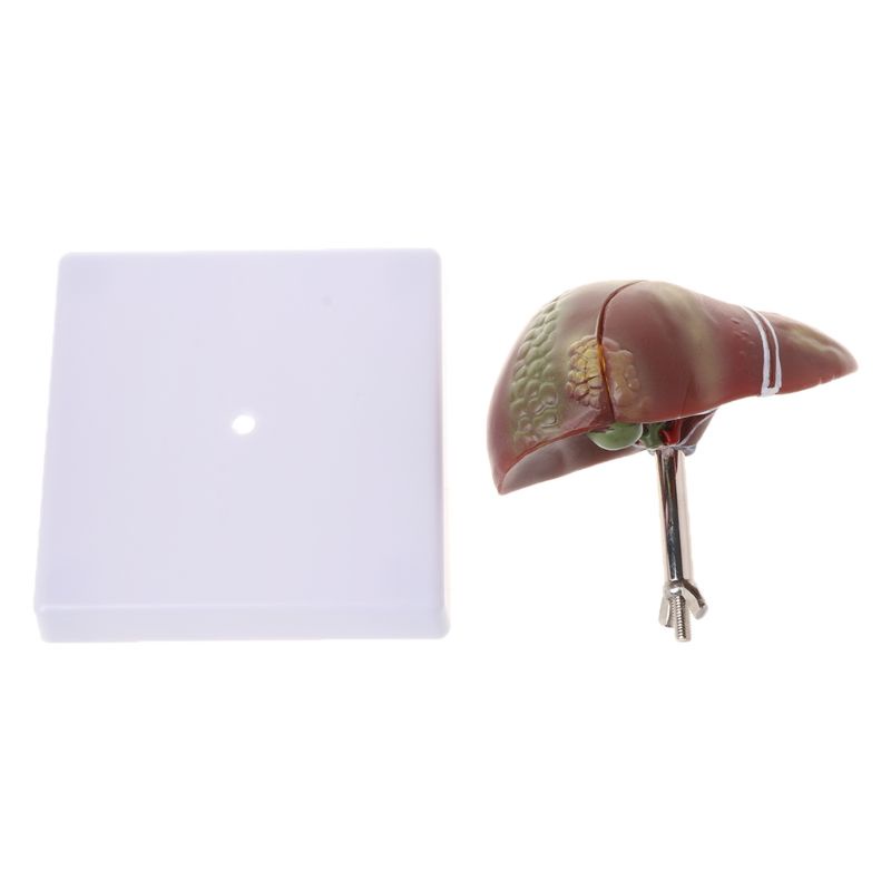 GOO Human Liver Pathological Anatomical Model Anatomy School Medical ...