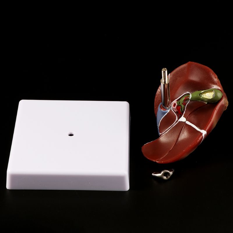 GOO Human Liver Pathological Anatomical Model Anatomy School Medical ...