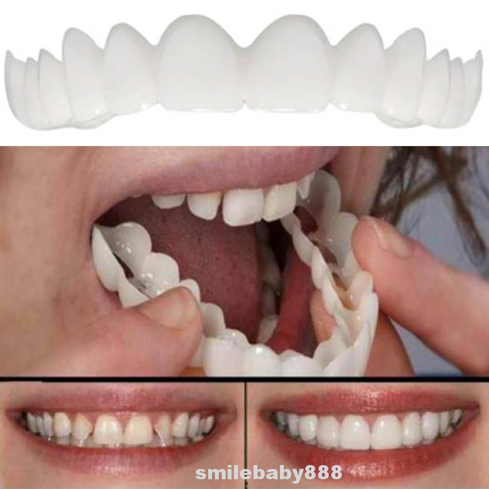 ∏[ความร้อน] Braces Orthodontics Adult Invisible and Transparent ...