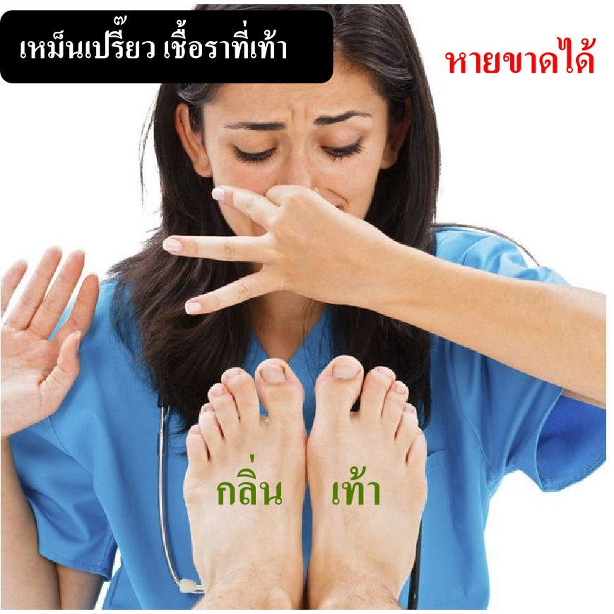 Jiao Qi Pian Fang สมุนไพรแก้เท้าเหม็น กลิ่นเท้า คันเท้า เท้าแตก เท้าลอก ...