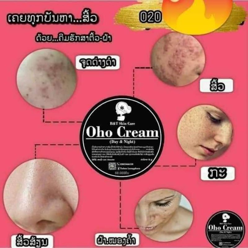 Oho Cream โอโหครีม ของแท้ໂອໂຫຄຣີມ) รักษาสิว-ฝ้า-กระ-จุดด่างดำ ครีมโอโห ຄີມໂອໂຫครีมลาวຄຣີມລາວคีม ...