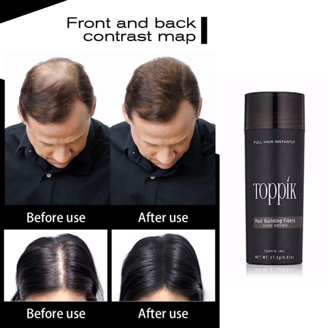 toppik ถูกที่สุด พร้อมโปรโมชั่น ก.พ. 2026 | BigGoเช็คราคาง่ายๆ